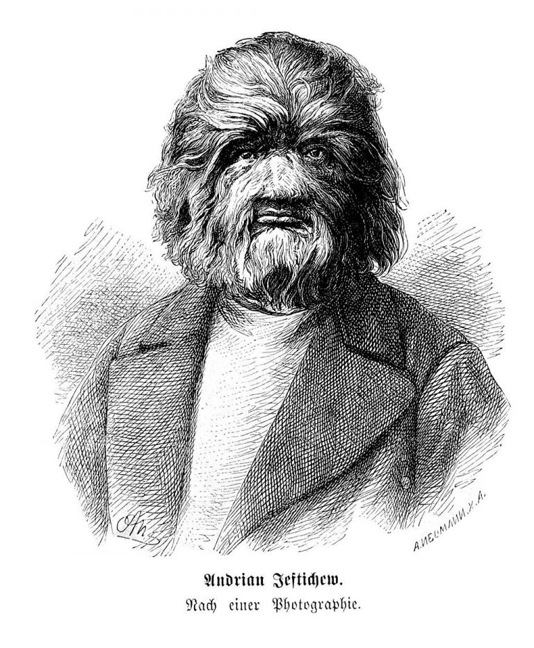 10 Most Bizarre Medical Conditions on Earth - The Best Health Degrees