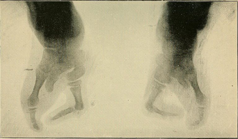 10 Most Bizarre Medical Conditions on Earth - The Best Health Degrees